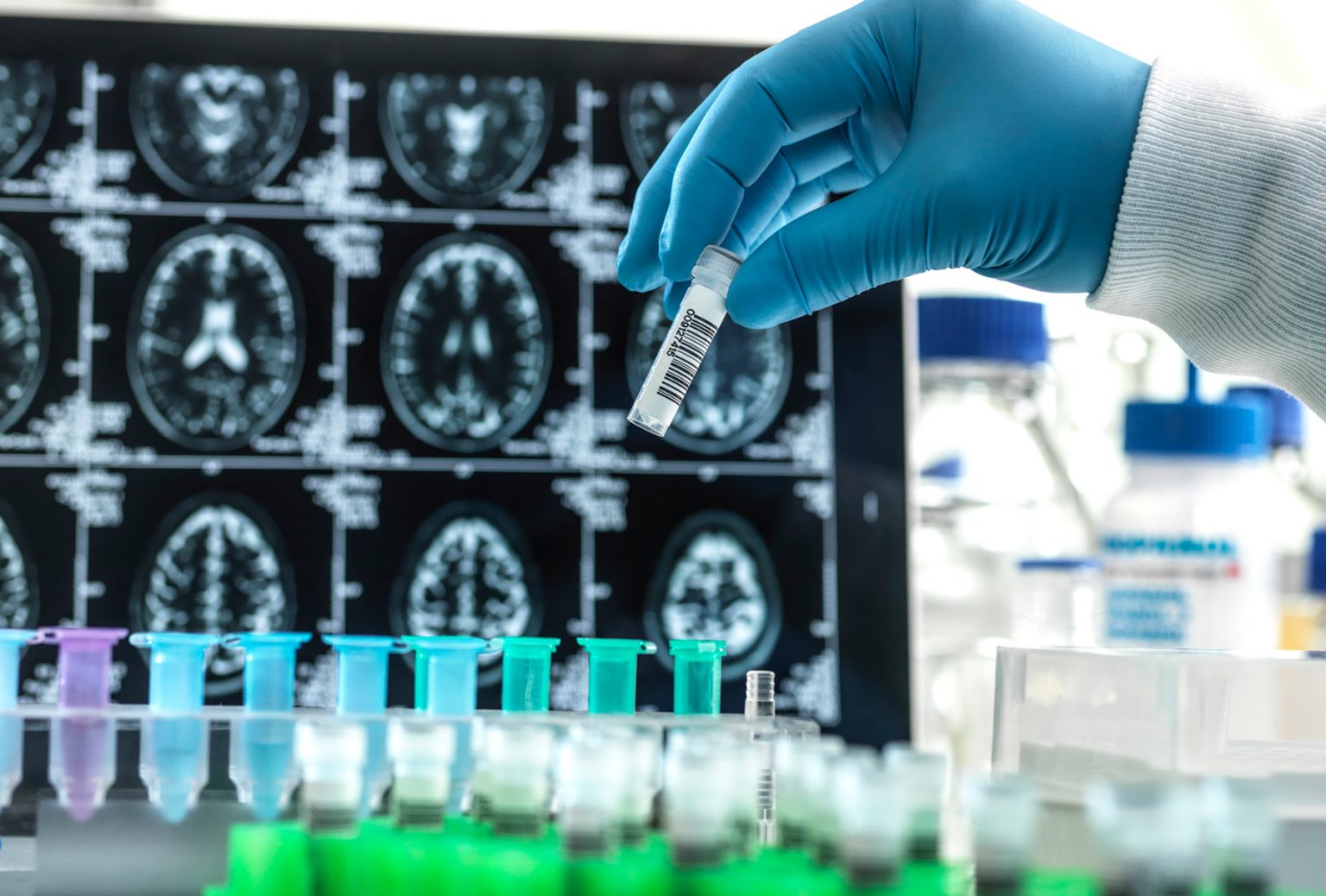 Lance Kawaguchi – Global