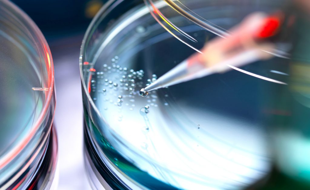 Sherry Shao – Global